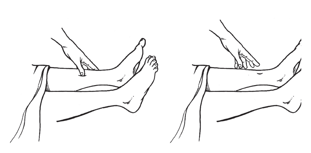 Inchaço nas pernas após o parto – Edema de membros inferiores – Dr ...